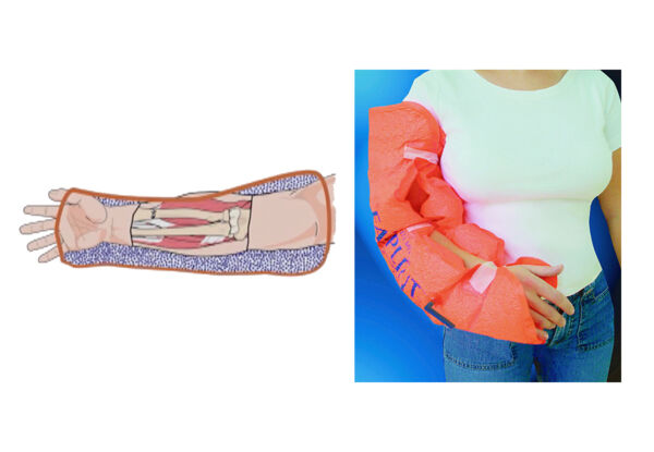 FASPLINT Extremity Splint - Hartwell Medical